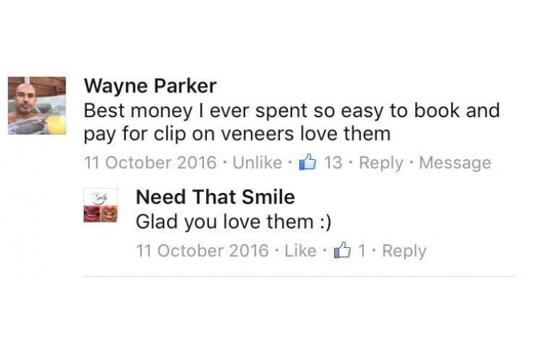 Clip In Veneers from Need That Smile – Affordable, Pain Free, Next Day ...