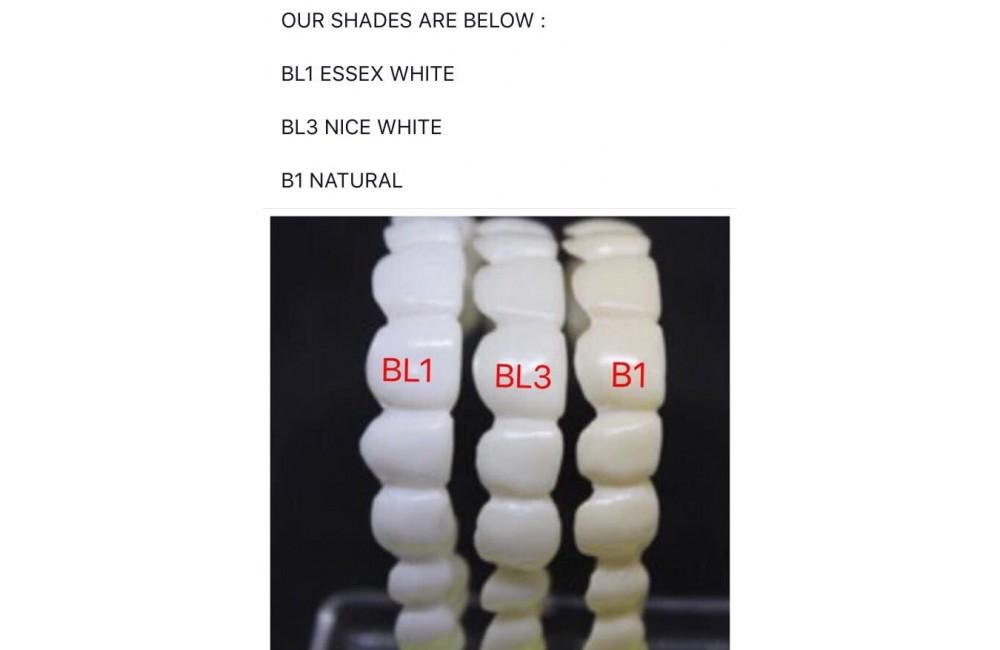 CLIP IN VENEERS – LOWER ONLY – IMPRESSION KIT INCLUDED – Clip In ...