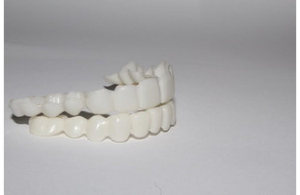 CLIP IN VENEERS – UPPER AND LOWER SET – IMPRESSION KIT INCLUDED – Clip ...