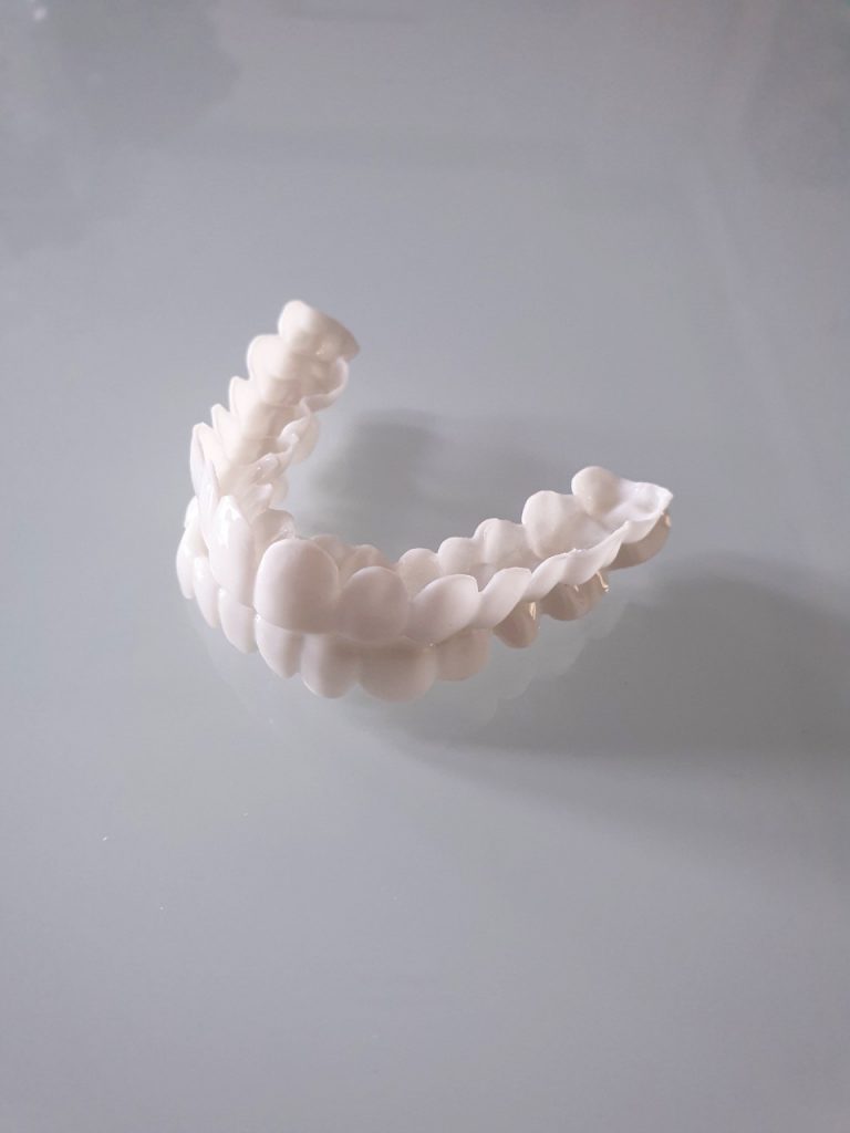 CLIP IN VENEERS - UPPER AND LOWER SET - IMPRESSION KIT INCLUDED - Clip ...